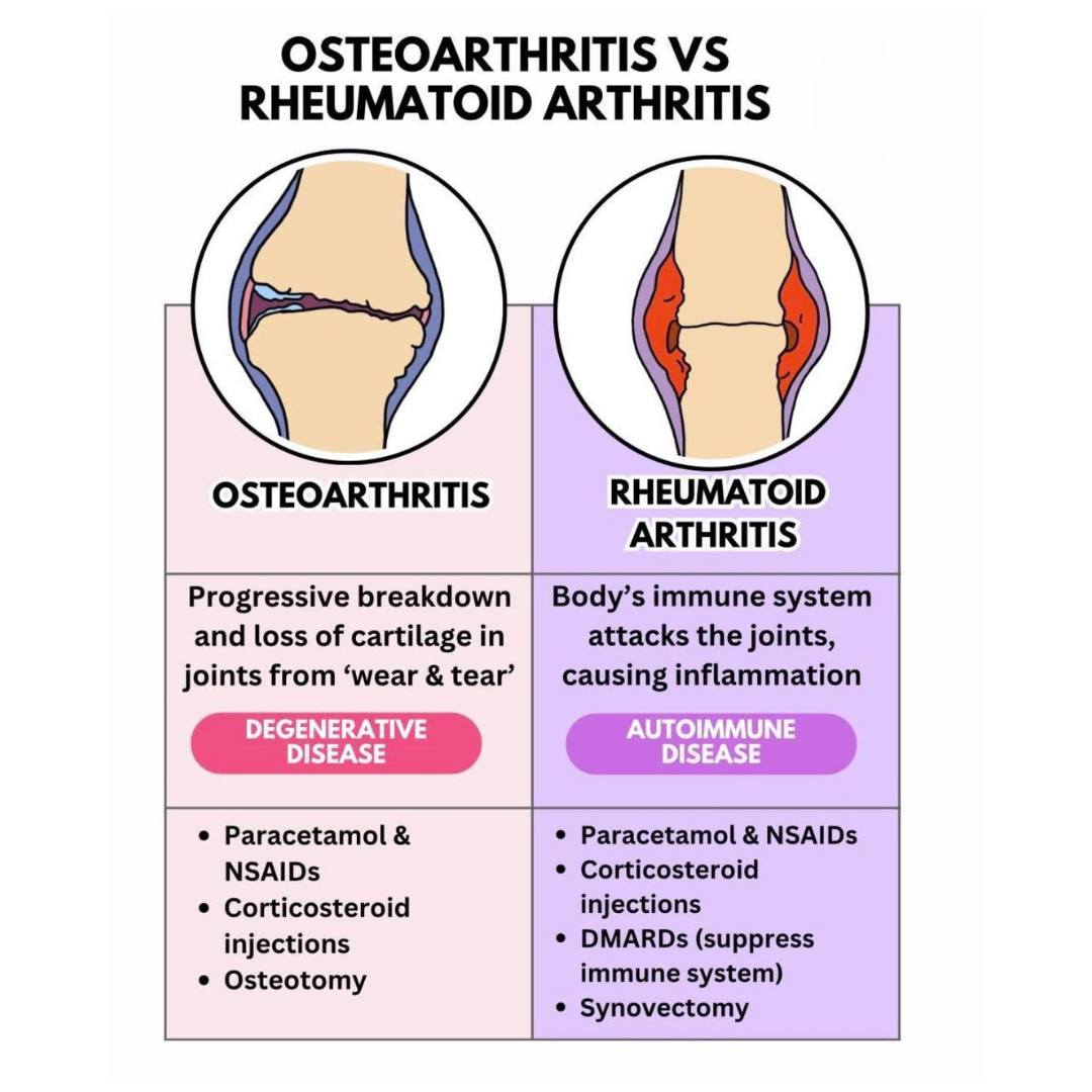 OSTEOARTHRITIS vs RHEUMATOID ARTHRITIS – Hayseeds Creative